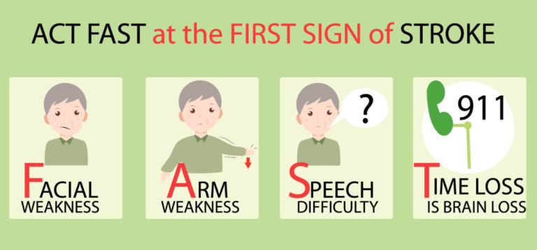 Warning Signs of Stroke in Young People - Healthier Steps