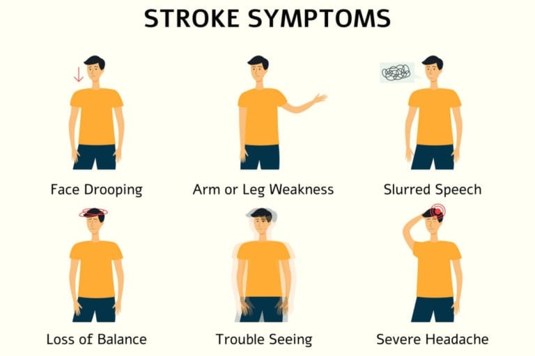 Warning Signs of Stroke in Young People - Healthier Steps